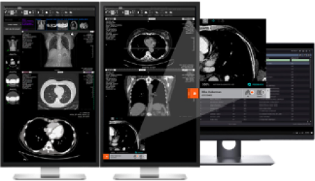 Israeli Aidoc Raises $150M with Nvidia Backing as AI Pushes Faster ...
